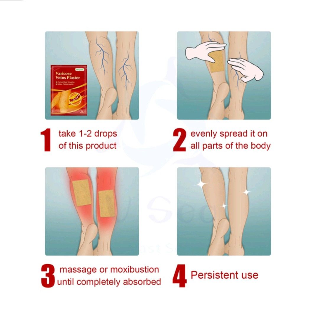 Varicose Veins Plaster, Beauty & Personal Care, Foot Care on Carousell