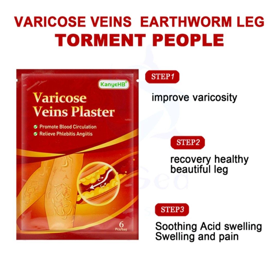 Varicose Veins Plaster, Beauty & Personal Care, Foot Care on Carousell