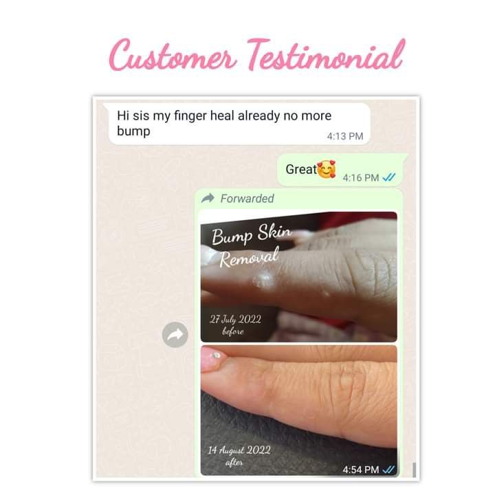 Milia Seed﻿,Skin Tag,Wart﻿,Syringoma,Tiny Bump,Oil Clog,Xanthelasma ...