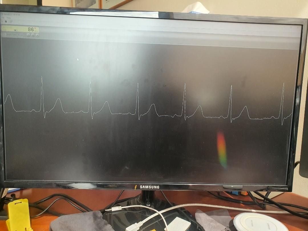 Nasco Life/Form interactive ECG Simulator & Alive ECG development kit ...