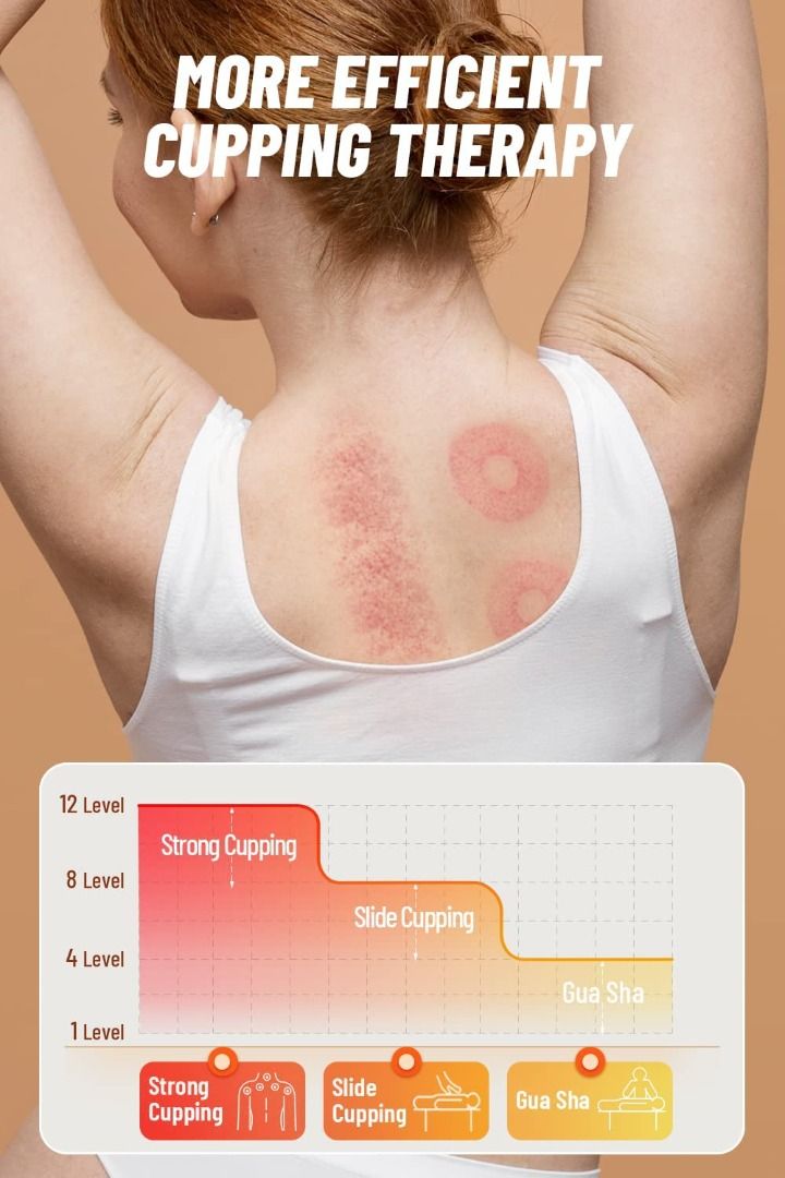 12 Levels Intensity Electric Cupping Therapy Machine, 3 in 1 Vacuum ...