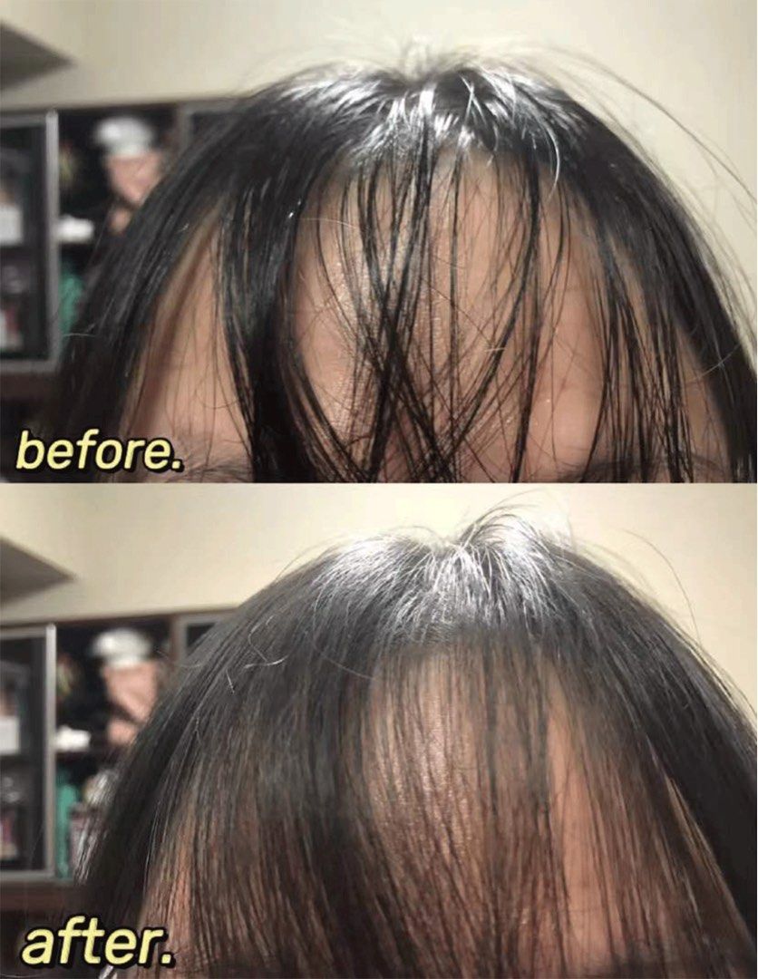 SPES dry shampoo Hot Douyin Original 150ml, Beauty & Personal Care ...