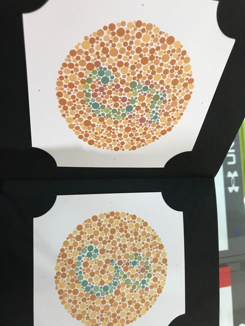 Ishihara colour plate test ( Color blindess), Health & Nutrition ...