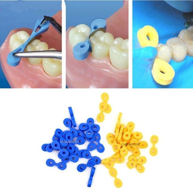 Dental Matrix Bands Rubber Fixation Elastic Wedges Sectional Contoured ...