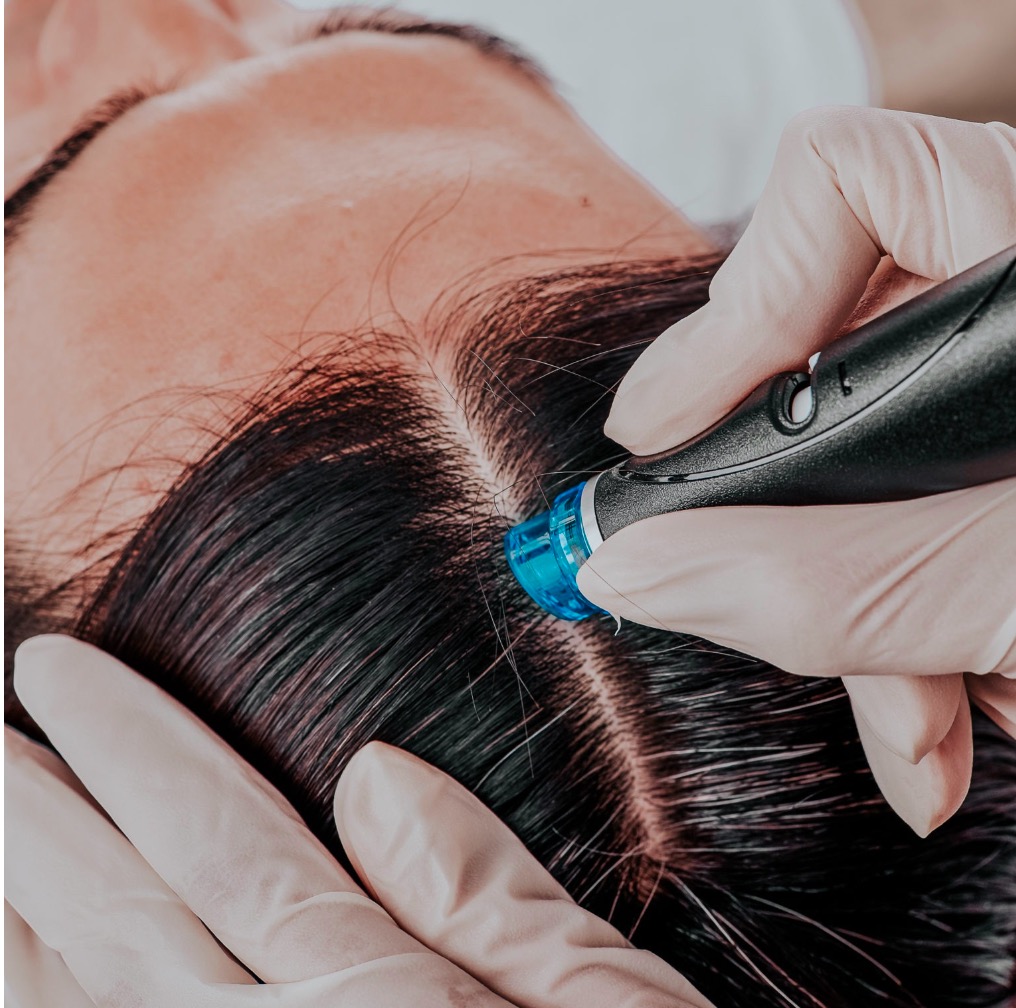 Hydra Scalp Deep Detox Cleansing Peeling with professional machine ...