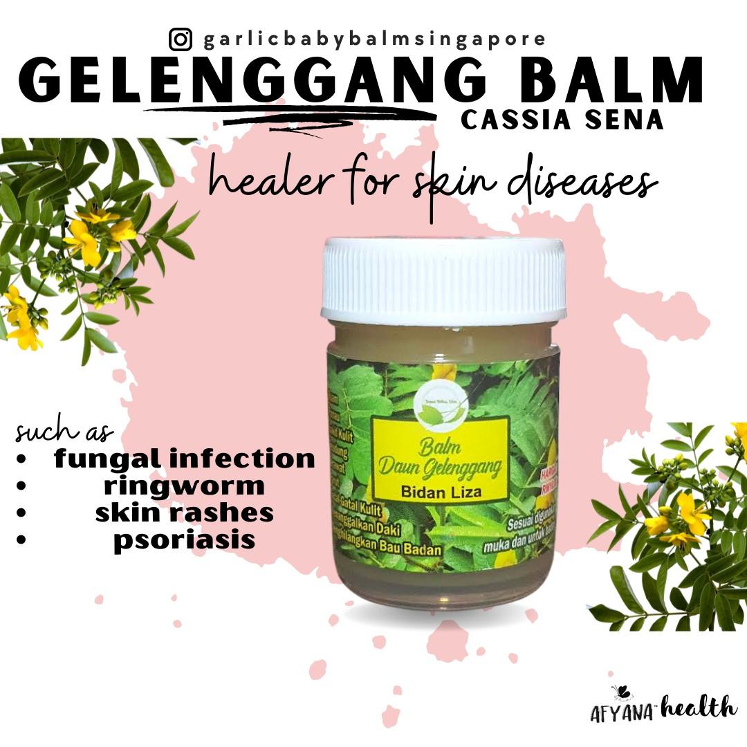 GELENGGANG SET ( CASSIA SENA ) SOAP / BALM / LOTION for fungal ...
