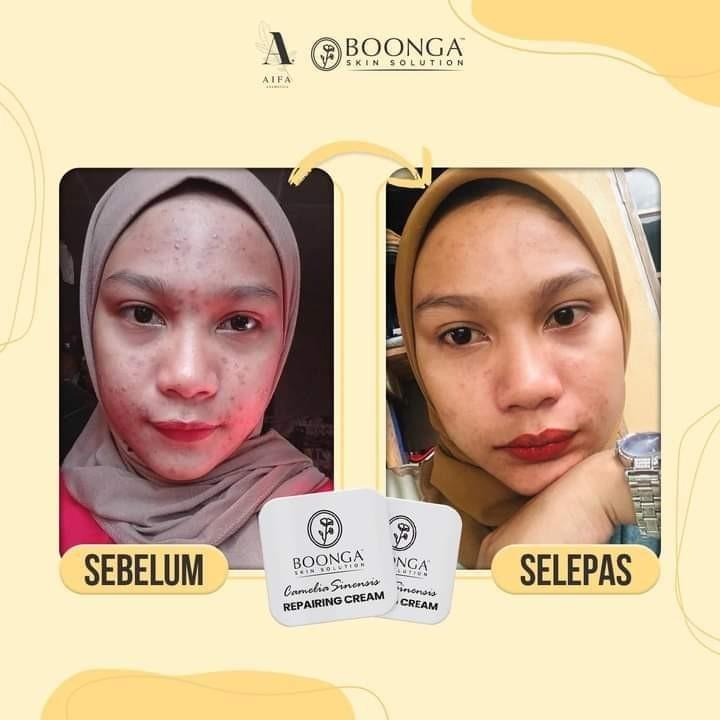 Brightening Repairing Cream Boonga By Aifa Azlan, Beauty & Personal ...