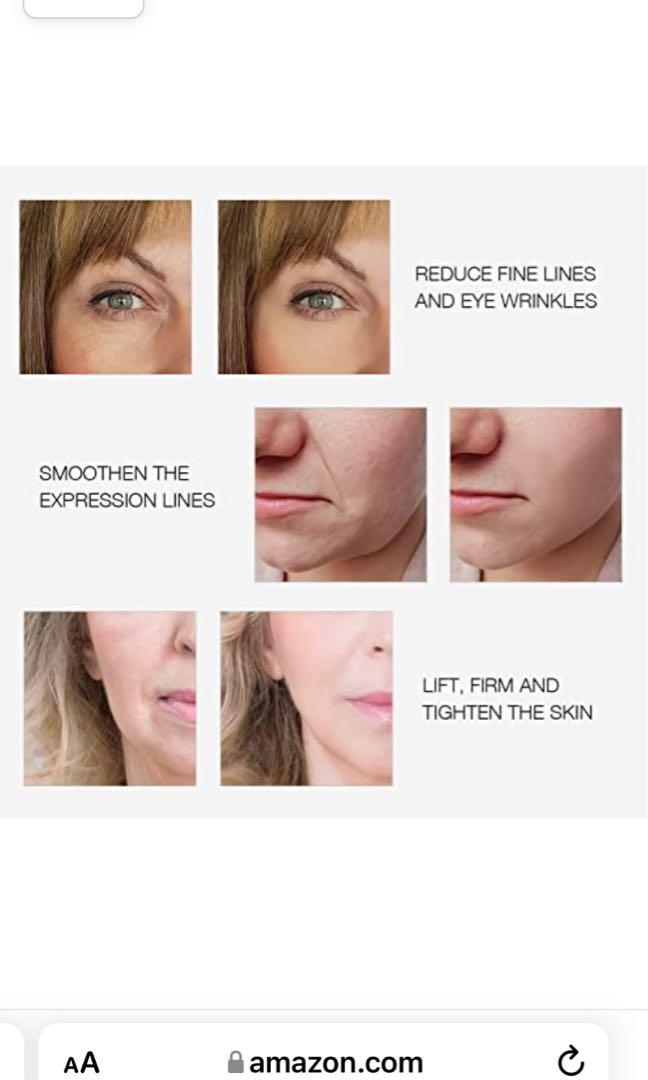 MLAY RF Radio Frequency Facial And Body Skin Tightening Machine ... MLAY RF Radio Frequency Facial And Body Skin Tightening Machine ...