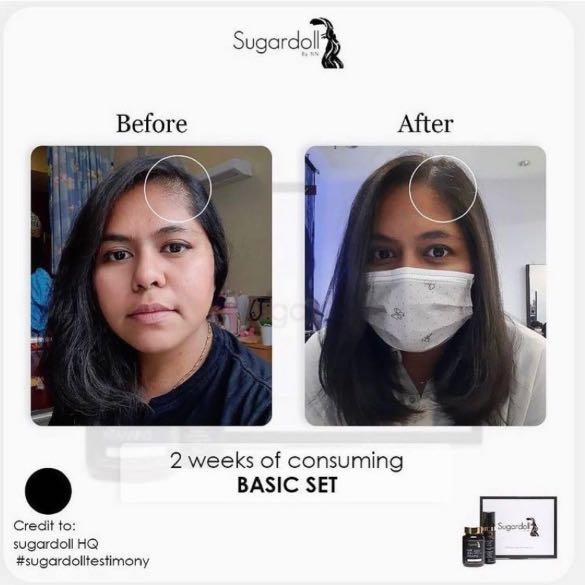 (FREE GIFT!) Sugardoll Hair Tonic, Skin & Hair Vitamin, Beauty ...