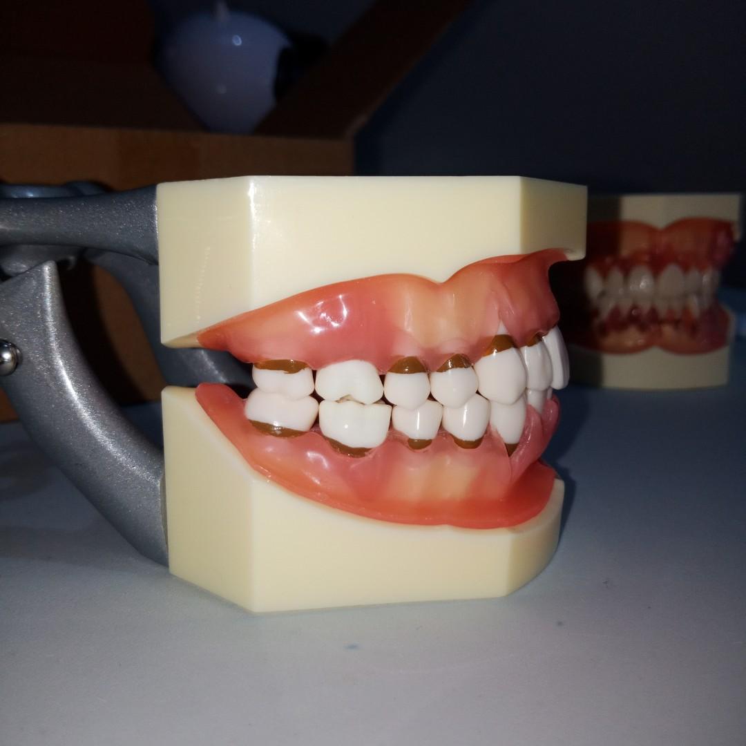 New Perio jaw model, Looking For on Carousell