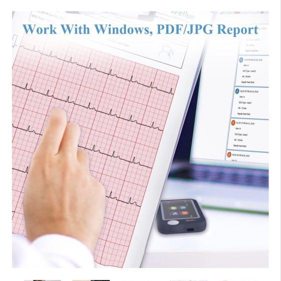 Wellue Heart Monitor,Portable ECG/EKG Monitor with Touch Screen and ...