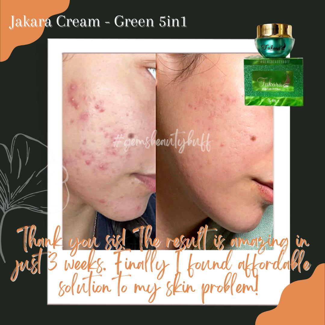 Jakara Cream, Beauty & Personal Care, Face, Face Care on Carousell