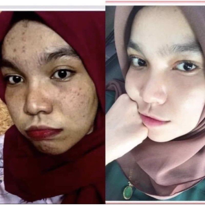 ORIGINAL ESW WHITENING SUPPLEMENT (EXTRA SKIN WHITENING), Health ...