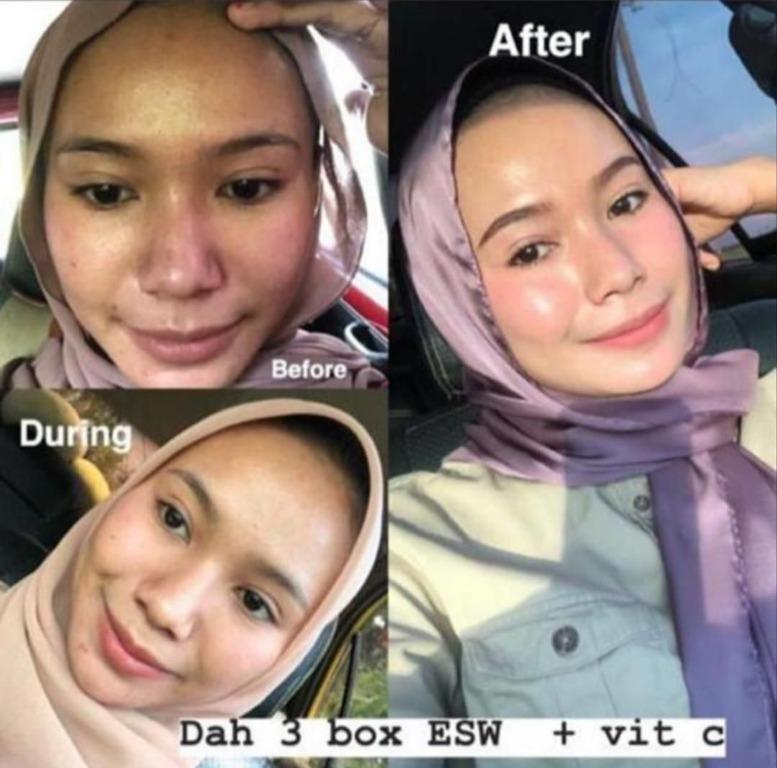 ORIGINAL ESW WHITENING SUPPLEMENT (EXTRA SKIN WHITENING), Health ...