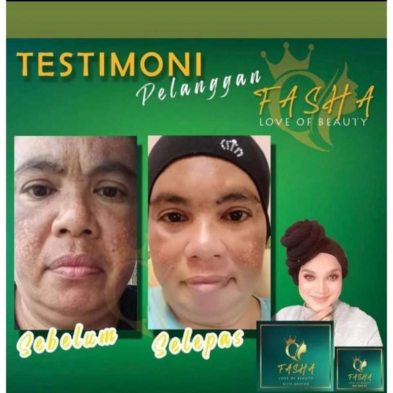 FASHA , Skin Care 4in 1, Beauty & Personal Care, Face, Face Care on ...