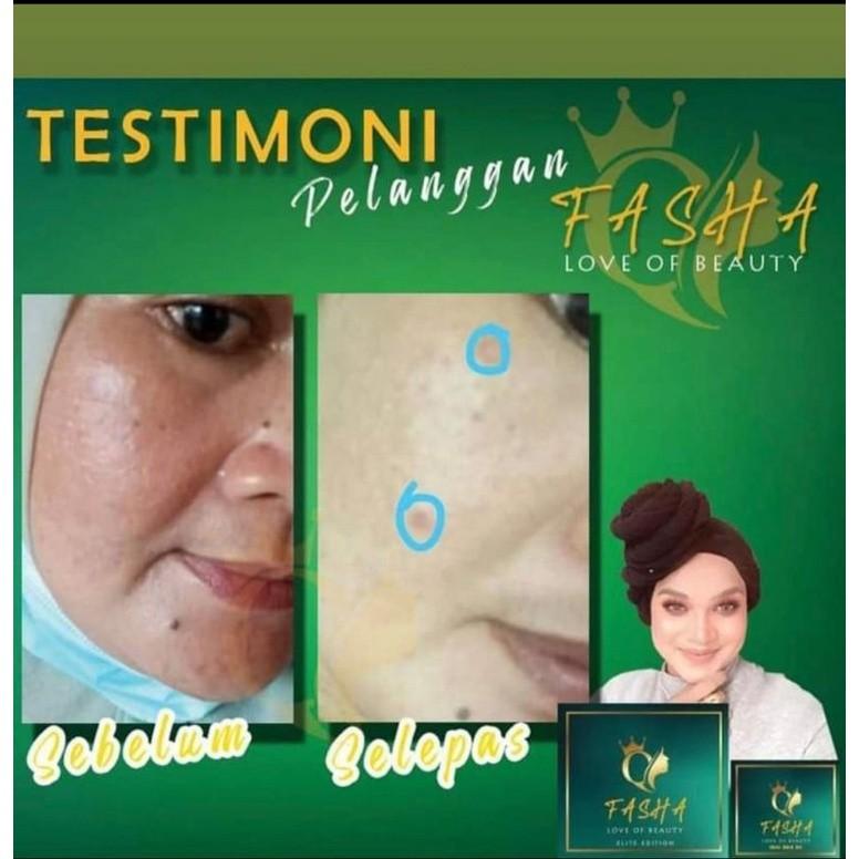 FASHA , Skin Care 4in 1, Beauty & Personal Care, Face, Face Care on ...