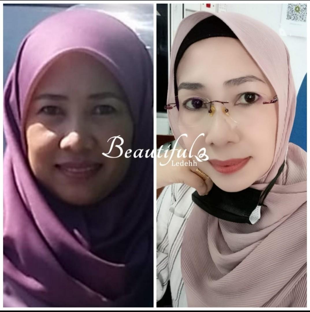 Beautiful Ledeh Skincare, Beauty & Personal Care, Face, Face Care on ...