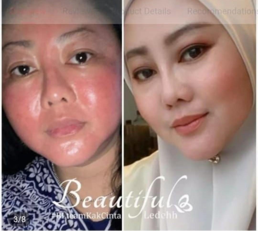 Beautiful Ledeh Skincare, Beauty & Personal Care, Face, Face Care on ...