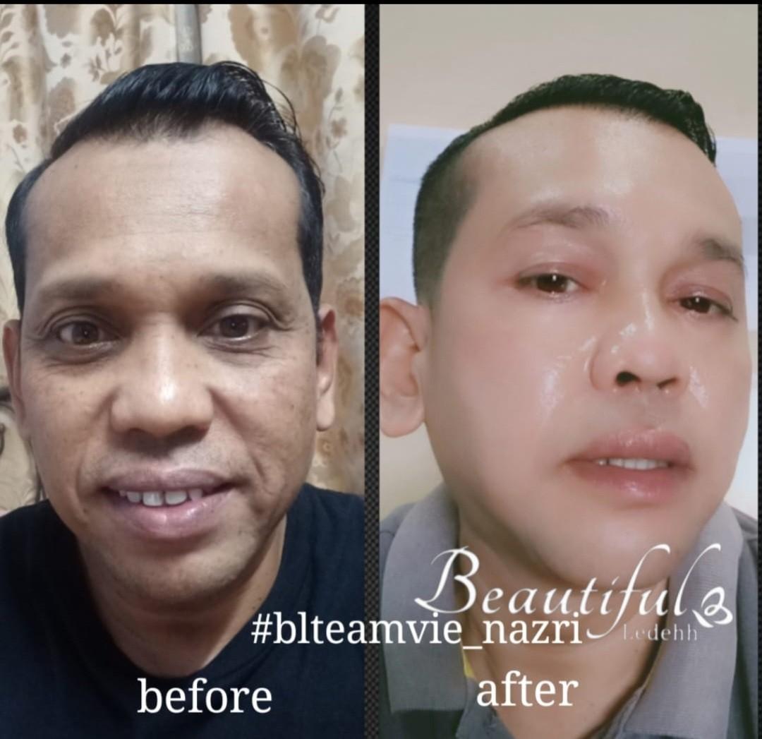 Beautiful Ledeh Skincare, Beauty & Personal Care, Face, Face Care on ...