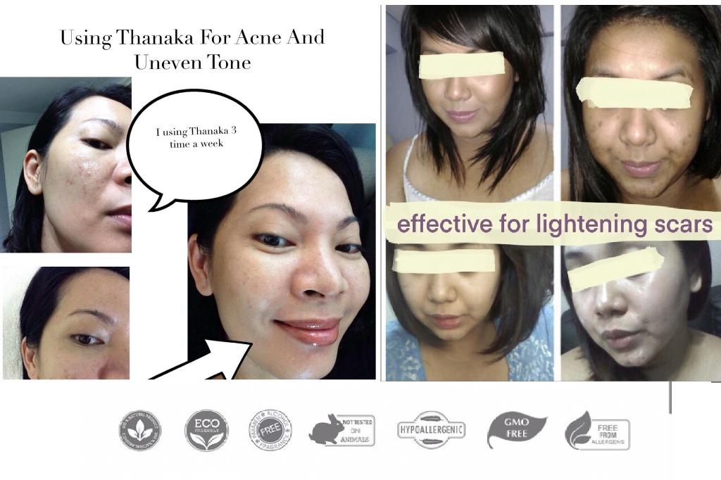 Premium Grade Thanaka Powder 50g Face Mask Cooling Anti itch sensitive ...