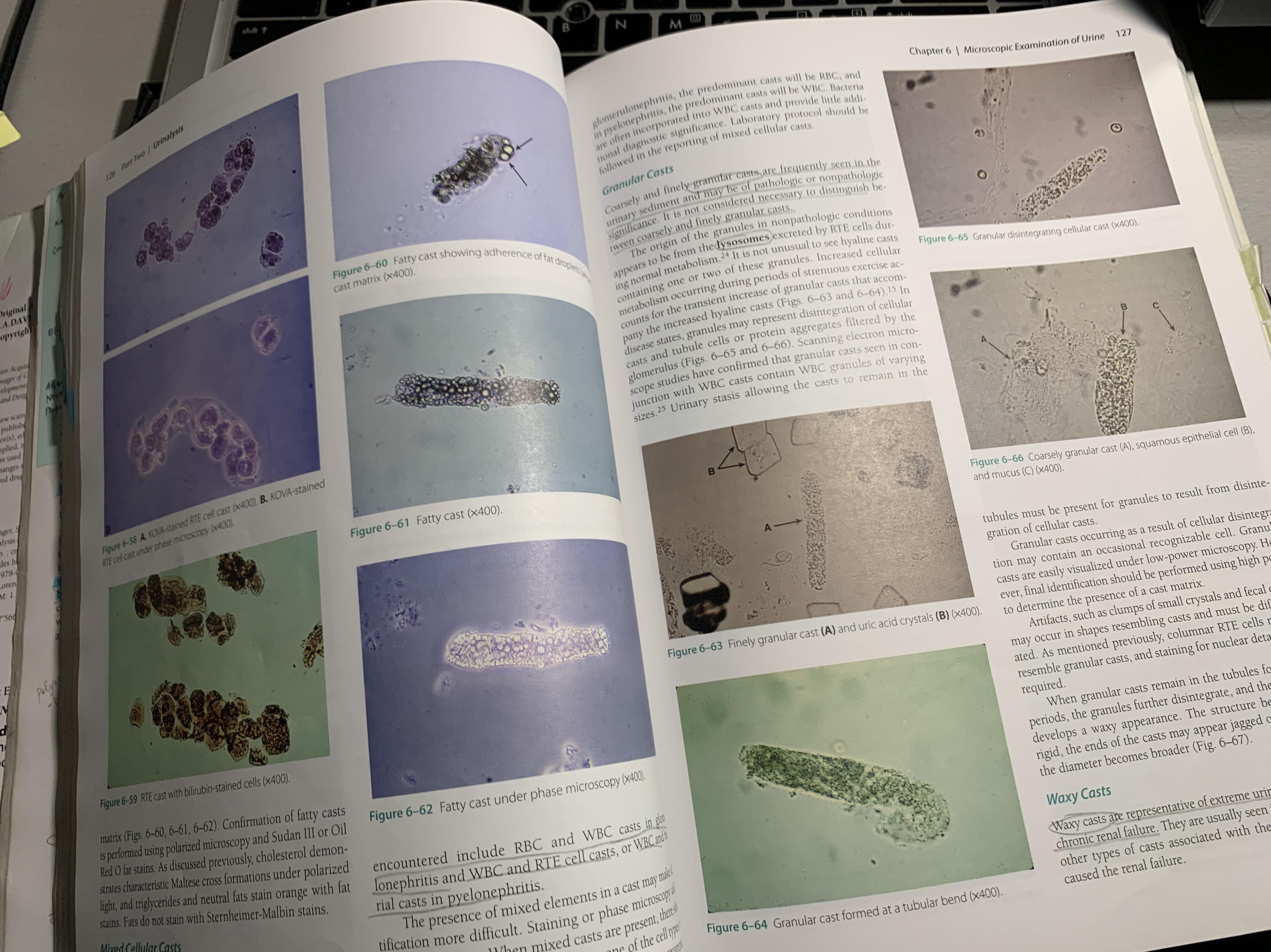 Strasinger Urinalysis and Body Fluids 6th Edition, Hobbies & Toys ...