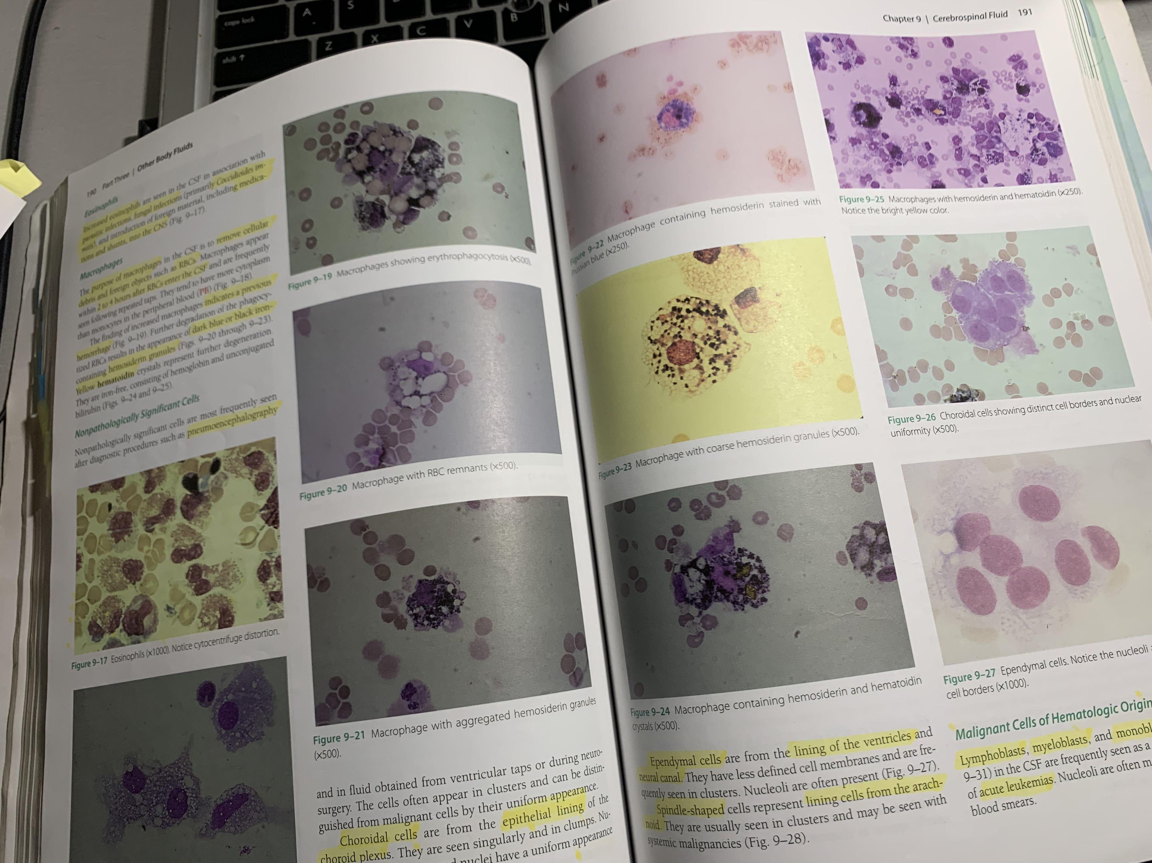 Strasinger Urinalysis and Body Fluids 6th Edition, Hobbies & Toys ...