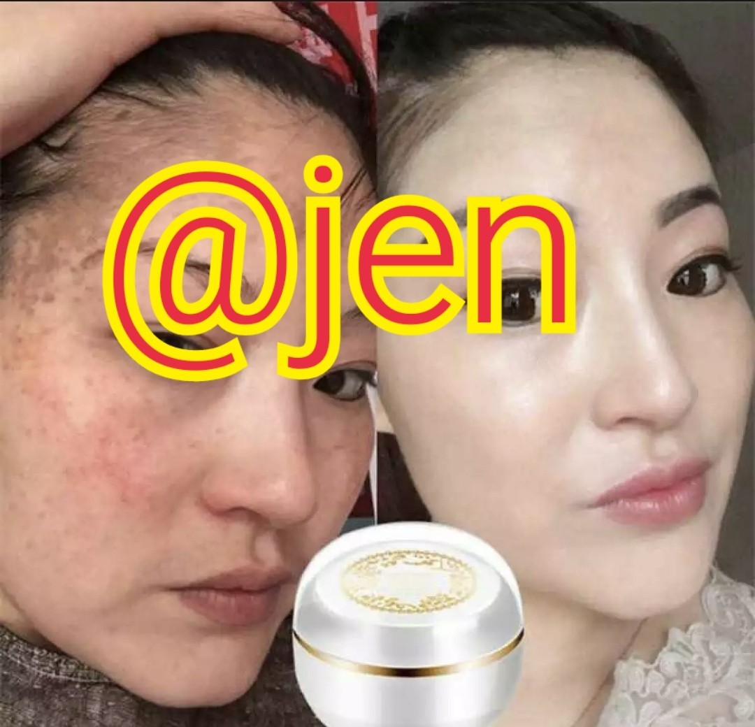 Best Selling Lighten Dark Spots Pearly Cream, Beauty & Personal Care ...