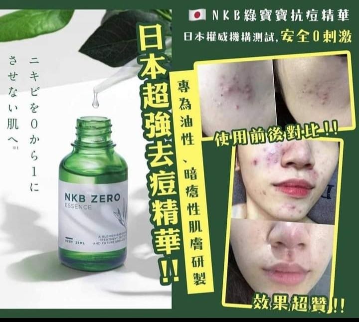 ‼️現貨‼️日本NKB Zero 淡印抗過敏抗痘修護美容精華 29ml, 美容＆化妝品, 健康及美容 - 皮膚護理, 面部 - 面部護理 - Carousell