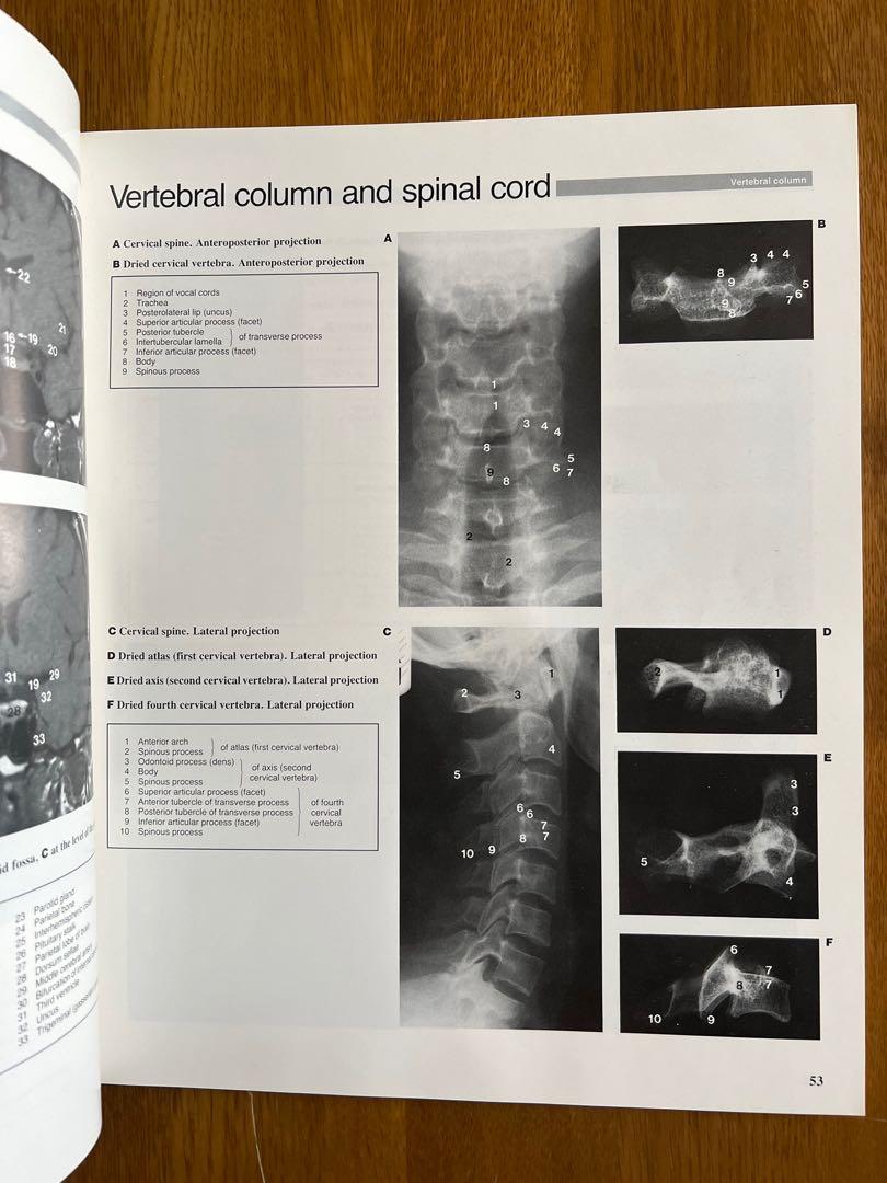 An Imaging Atlas of Human Anatomy, Hobbies & Toys, Books & Magazines ...