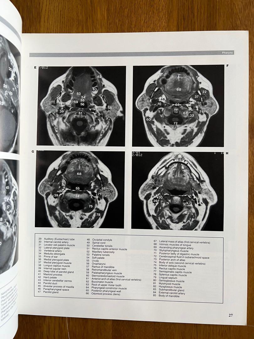 An Imaging Atlas of Human Anatomy, Hobbies & Toys, Books & Magazines ...