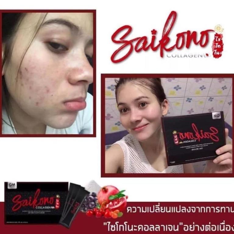 GM Brand Saikono Collagen Supplement Drink For Glowing Skin (Halal Certified) 15.5g x 10 sachets ...