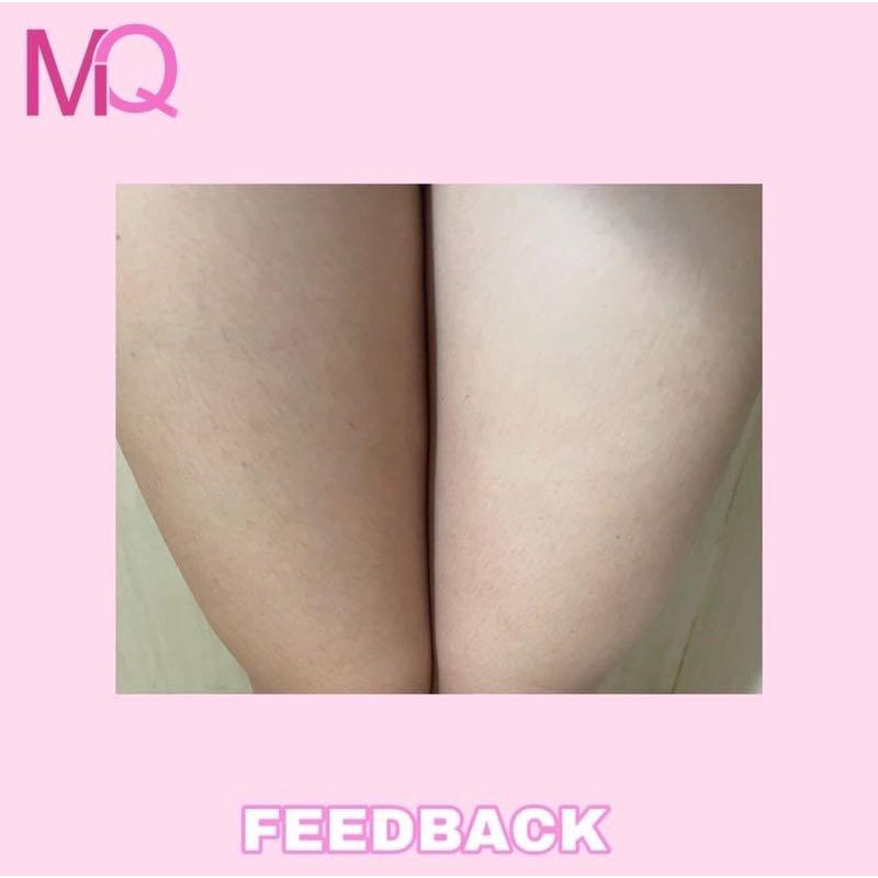 Mq Cosmetics Bleaching Soap Beauty And Personal Care Bath And Body Body