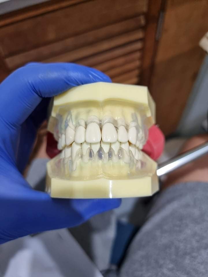 Perio Typodont Jaw Model, Health & Nutrition, Medical Supplies & Tools ...