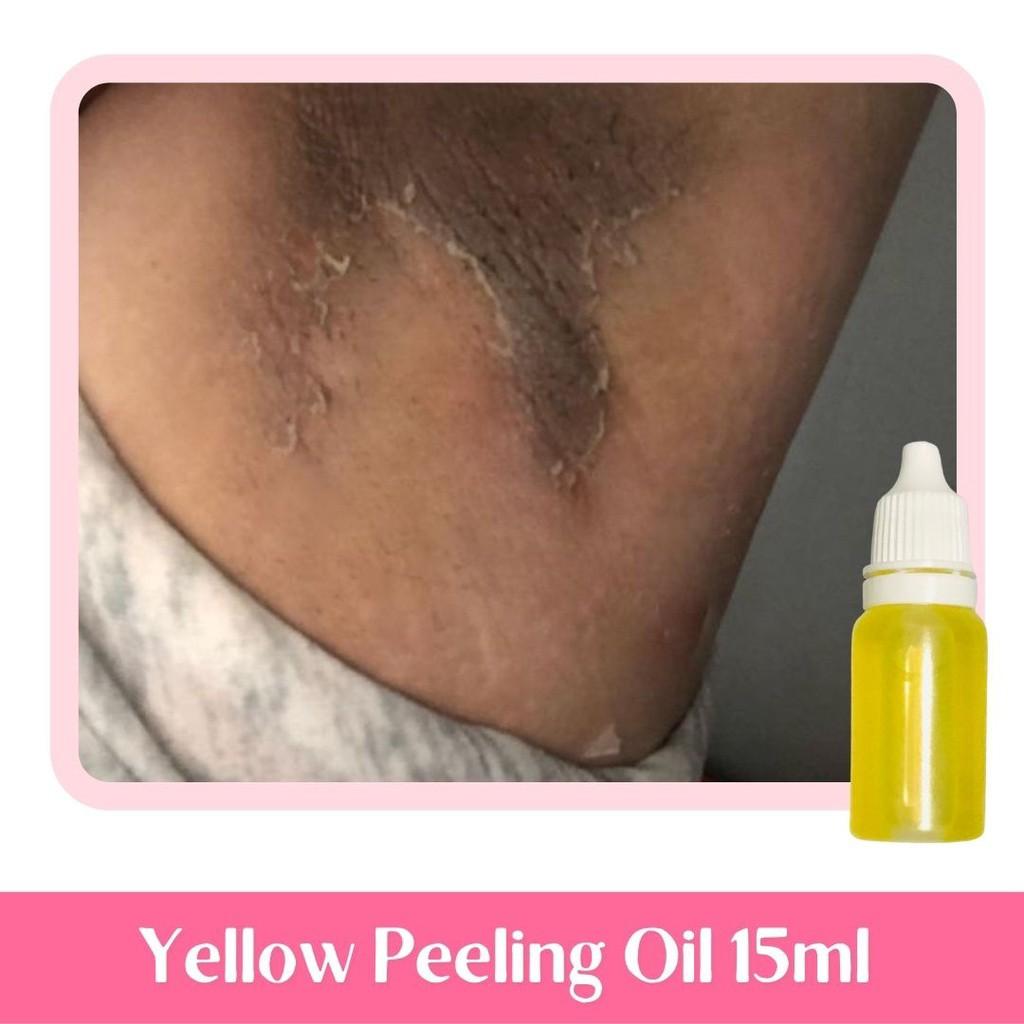 Underarm Peeling Oil, Beauty & Personal Care, Bath & Body, Body Care on ...