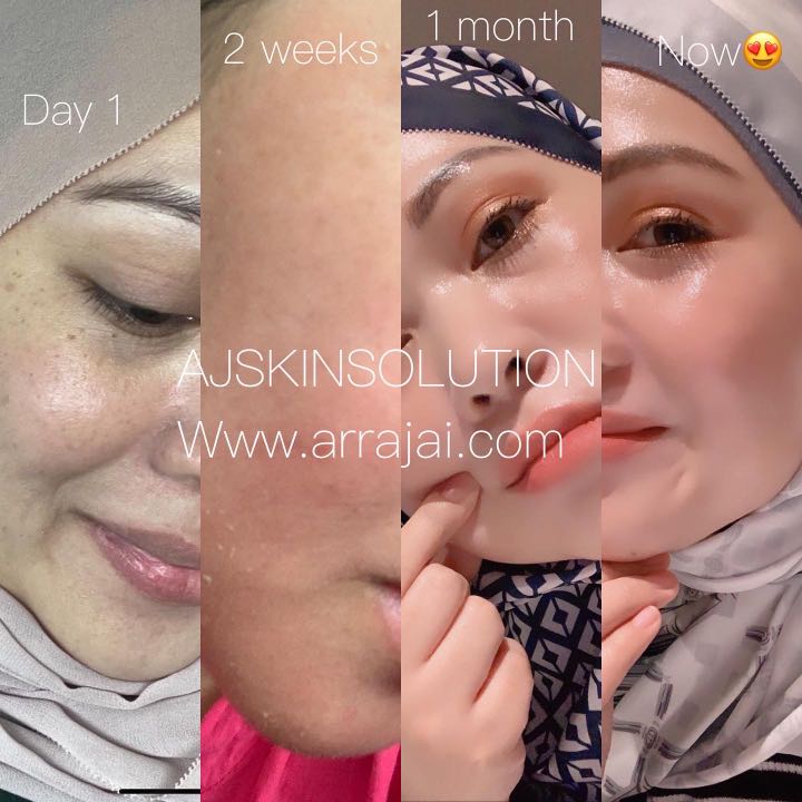Aj skin solution - SET JERAGAT & whitening, Beauty & Personal Care ...