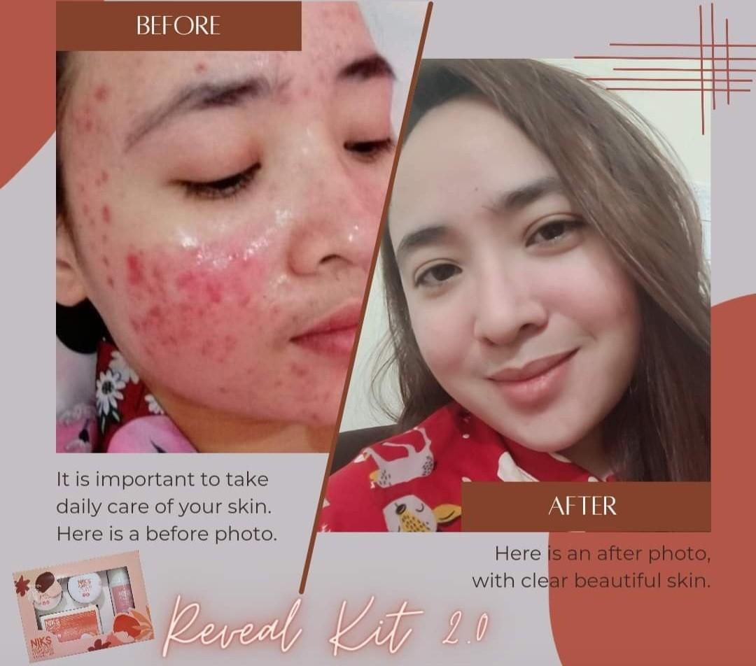 Niks Skin Reveal Kit 2.0, Beauty & Personal Care, Face, Face Care on ...