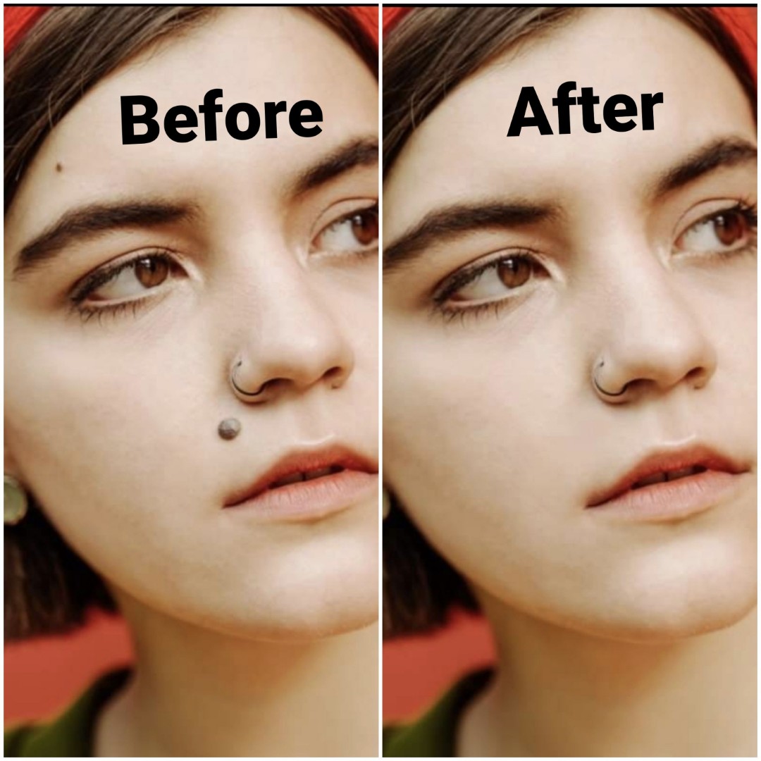 Photo editing remove moles , scars , piercings and more! / photo ...