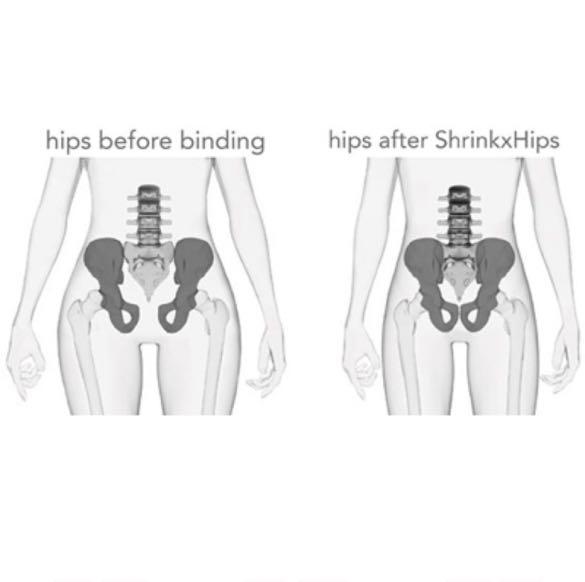 Upspring Shrinkx Hips Post Pregnancy Hip Compression Belt - Black ...