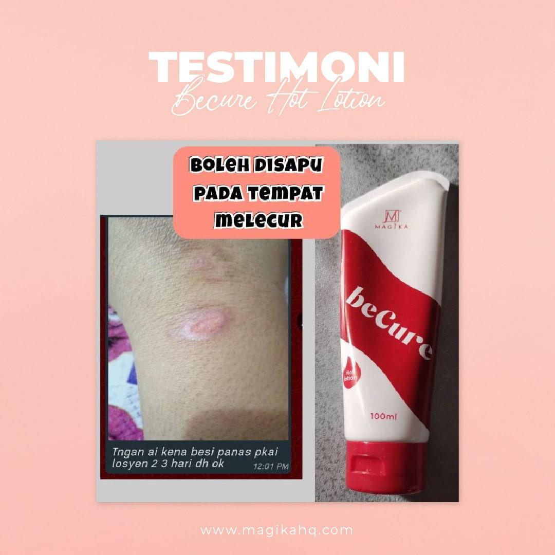 Becure Hot Lotion, Beauty & Personal Care, Bath & Body, Body Care on ...