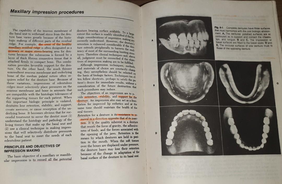 Condensed on Bouchers Prosthodontic Treatment for Edentulous Patients ...