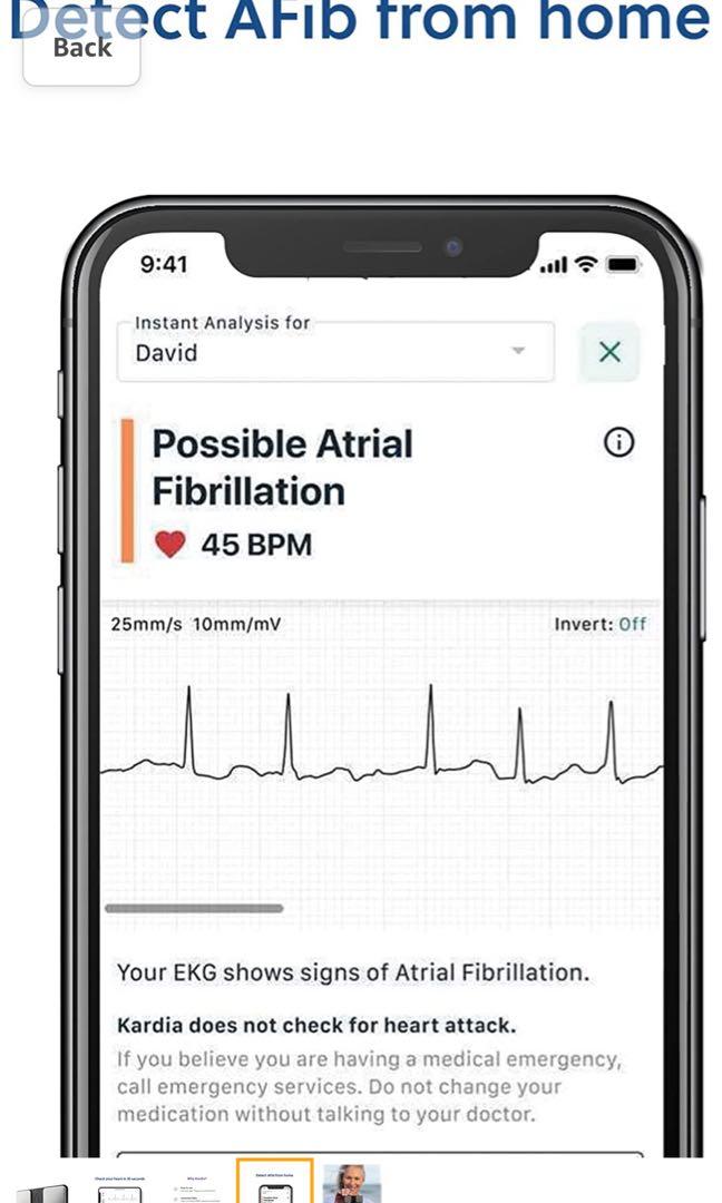 KardiaMobile Personal EKG Device and Heart Monitor - Single-Lead EKG - 3 Detections - Detect ...