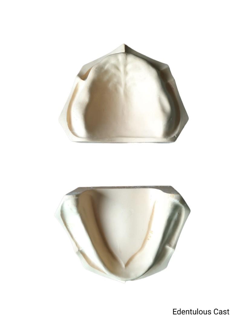 Edentulous Cast, Health & Nutrition, Medical Supplies & Tools on Carousell