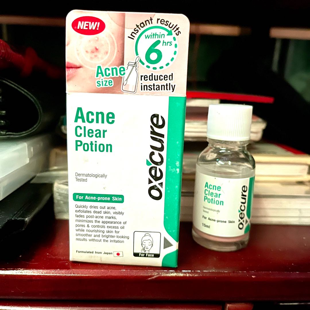 Oxecure Acne Clear Potion x 2 with FREE Garnier Milky Dew Toner, Beauty ...