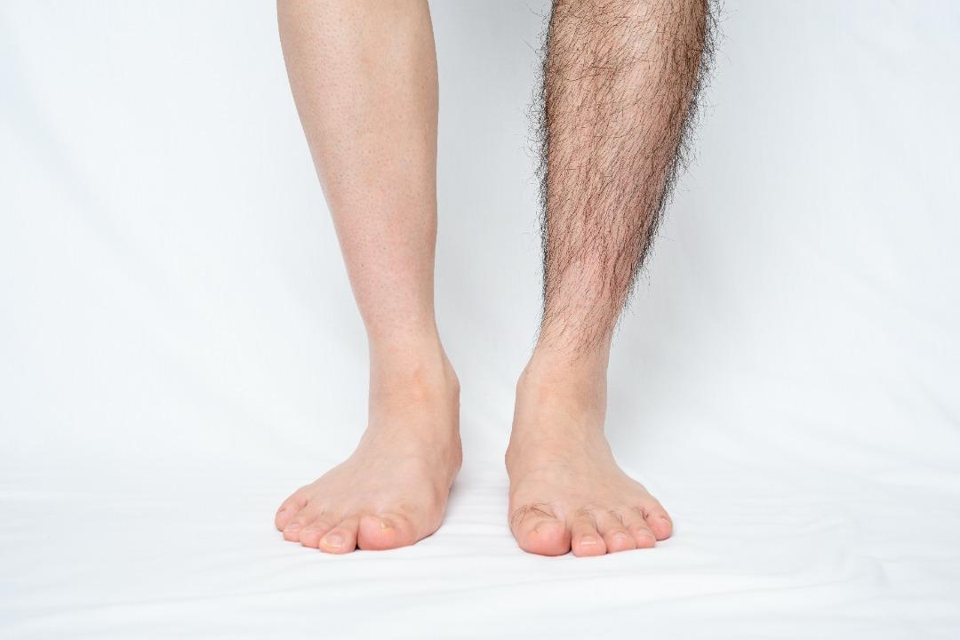 $58 Boyzilian Manzilian Laser Hair Removal. By Male therapist., Beauty ...