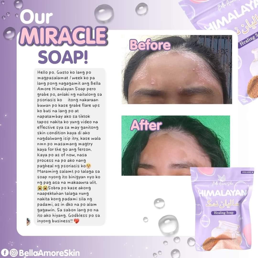 Bella Amore Skin Himalayan Healing Soap, Beauty & Personal Care, Bath ...