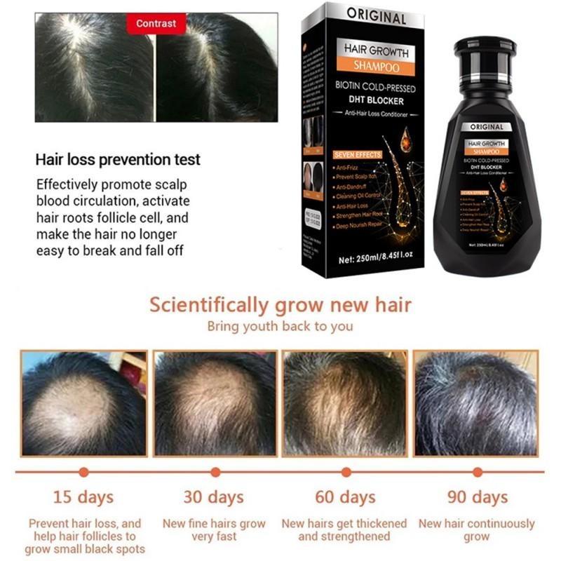 PEI MEI DHT Blocker Anti Hair Loss hair growth shampoo biotin ...