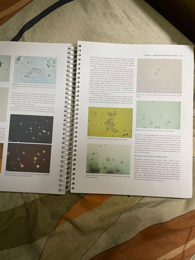 Strasinger | Urinalysis and Body Fluids, Hobbies & Toys, Books ...