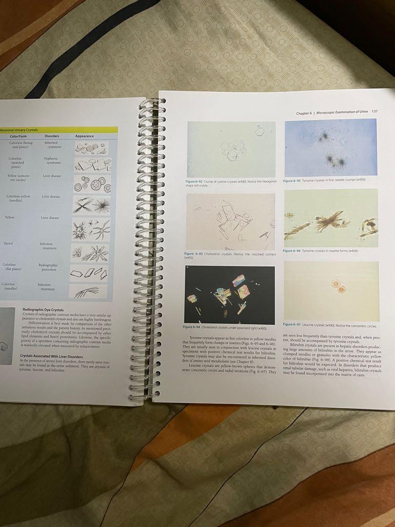 Strasinger | Urinalysis and Body Fluids, Hobbies & Toys, Books ...