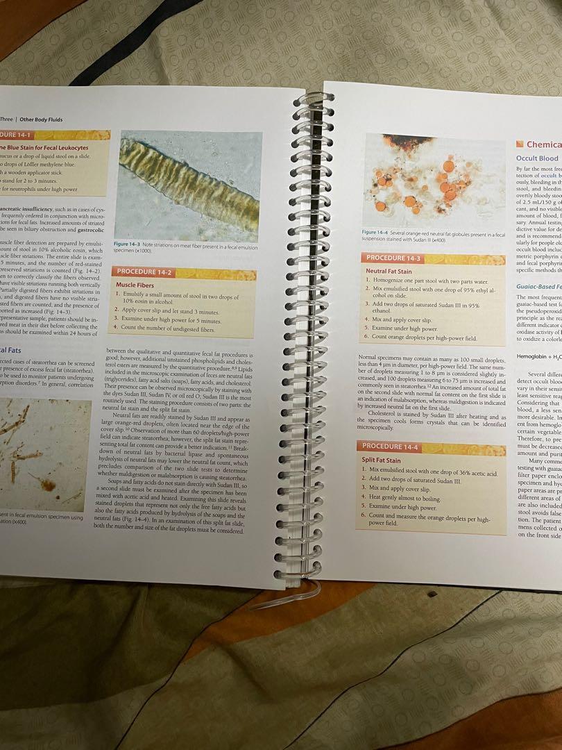 Strasinger | Urinalysis and Body Fluids, Hobbies & Toys, Books ...