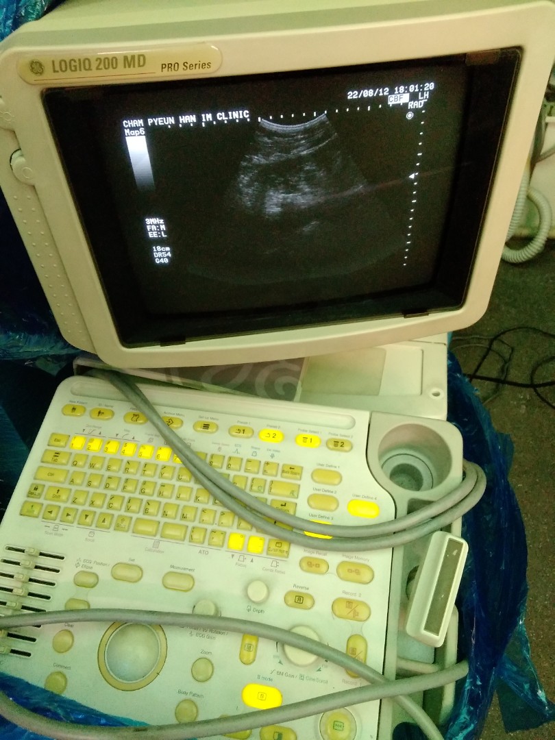 Ultrasound logiq200, Everything Else, Others on Carousell